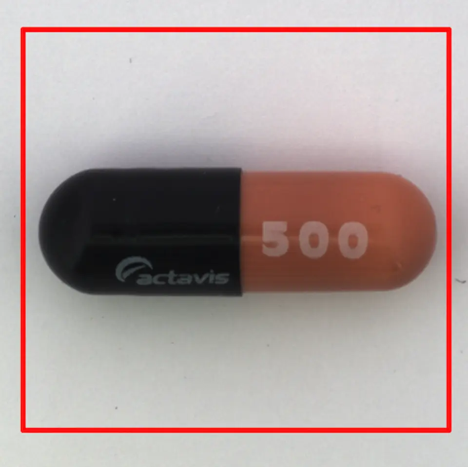 PaDiMとPatchCoreどちらを選ぶべき？異常検知モデルの選択肢を見極めるポイント｜調和技研ブログ